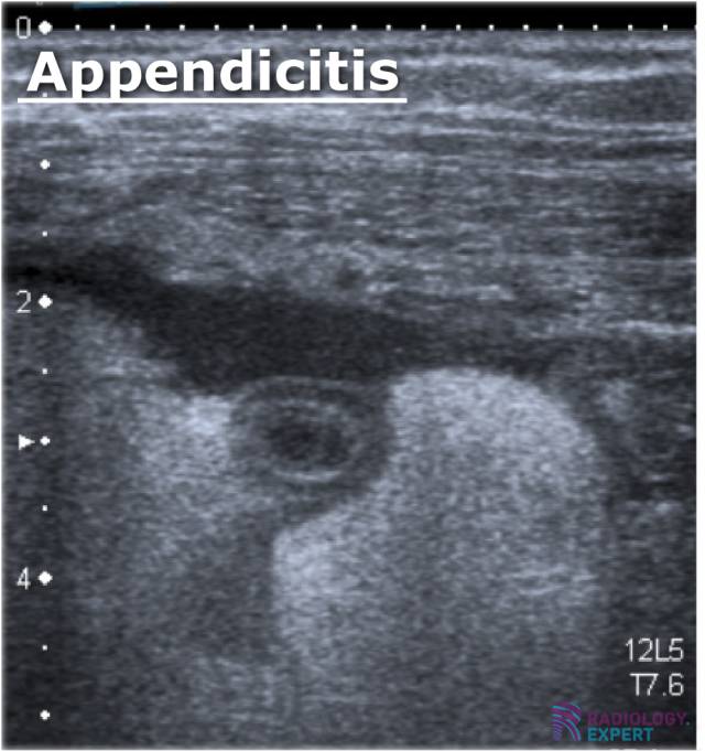 Indicatiestelling en Aanvragen Radiologisch Onderzoek