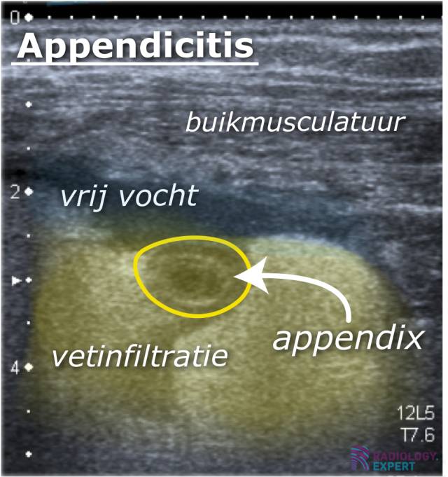 Indicatiestelling en Aanvragen Radiologisch Onderzoek