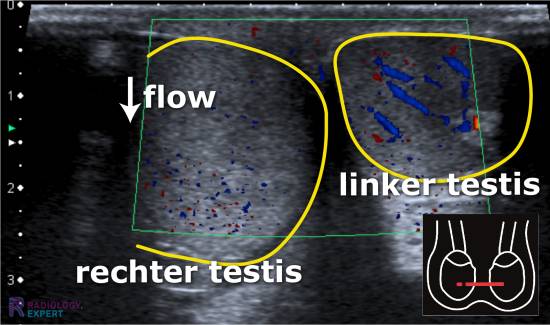 Indicatiestelling en Aanvragen Radiologisch Onderzoek