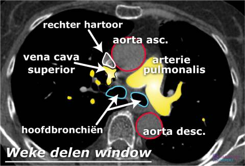 Indicatiestelling en Aanvragen Radiologisch Onderzoek