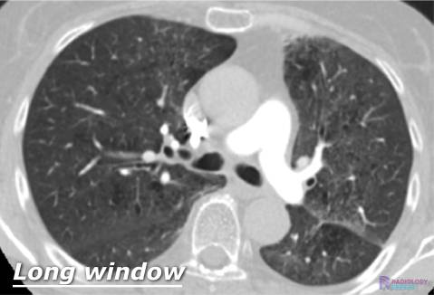 Indicatiestelling en Aanvragen Radiologisch Onderzoek