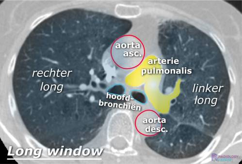 Indicatiestelling en Aanvragen Radiologisch Onderzoek