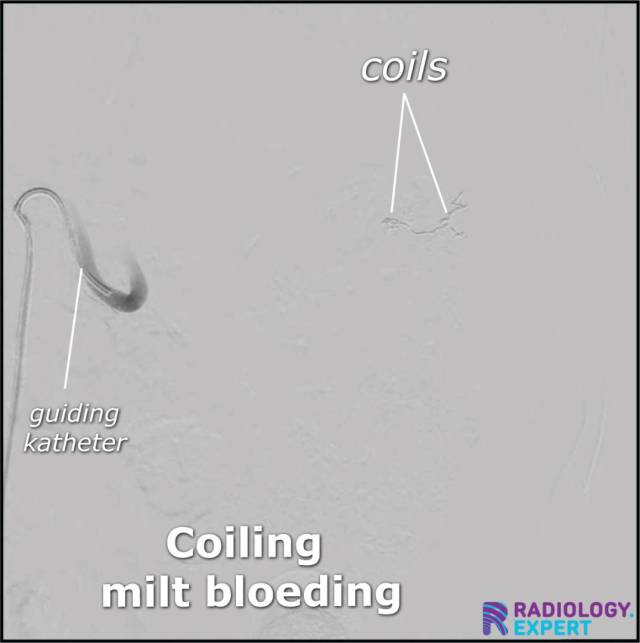 Interventional Radiology - General