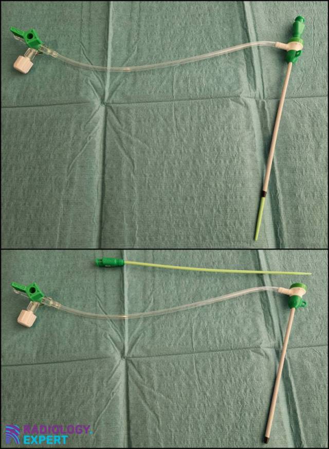 Interventional Radiology - General