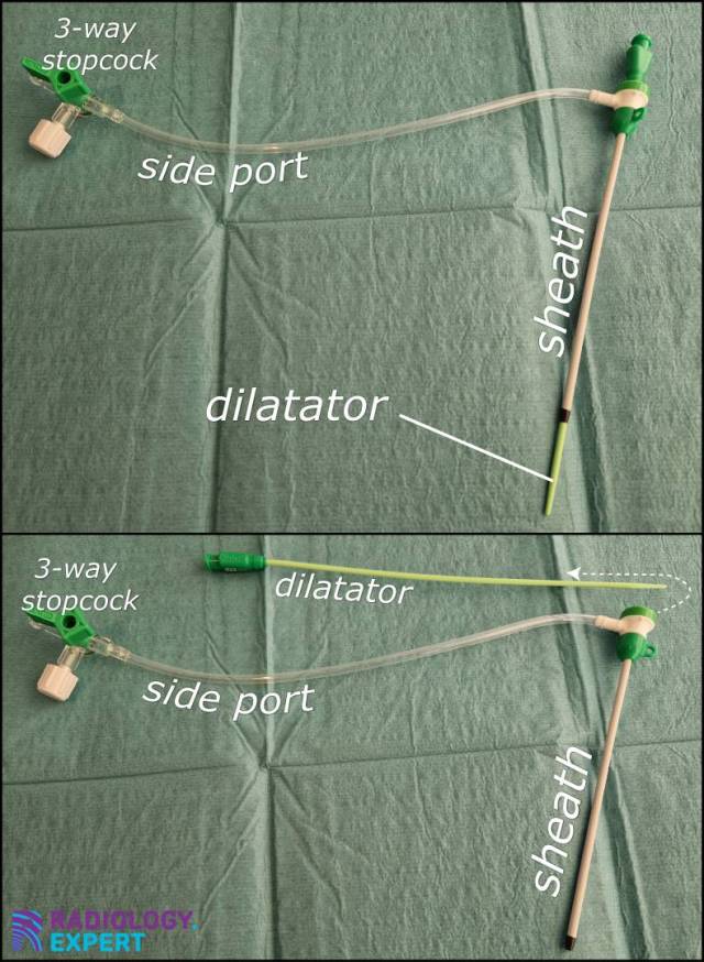 Interventional Radiology - General