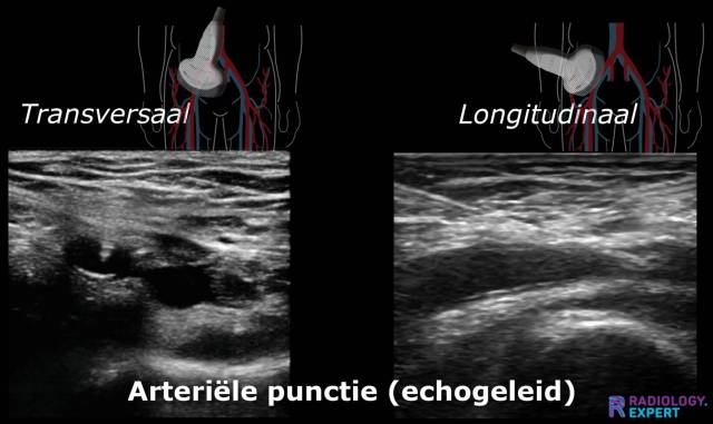 Interventie Radiologie - Algemeen