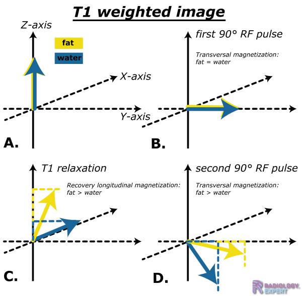 MRI Technique