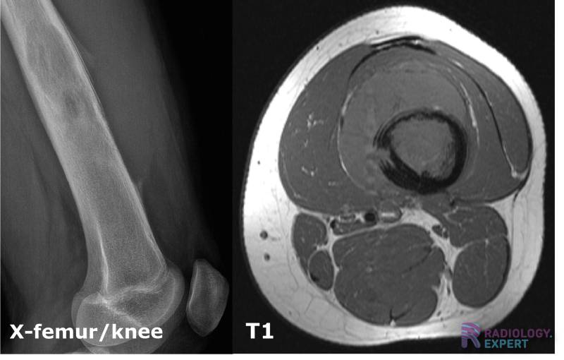 MRI Technique