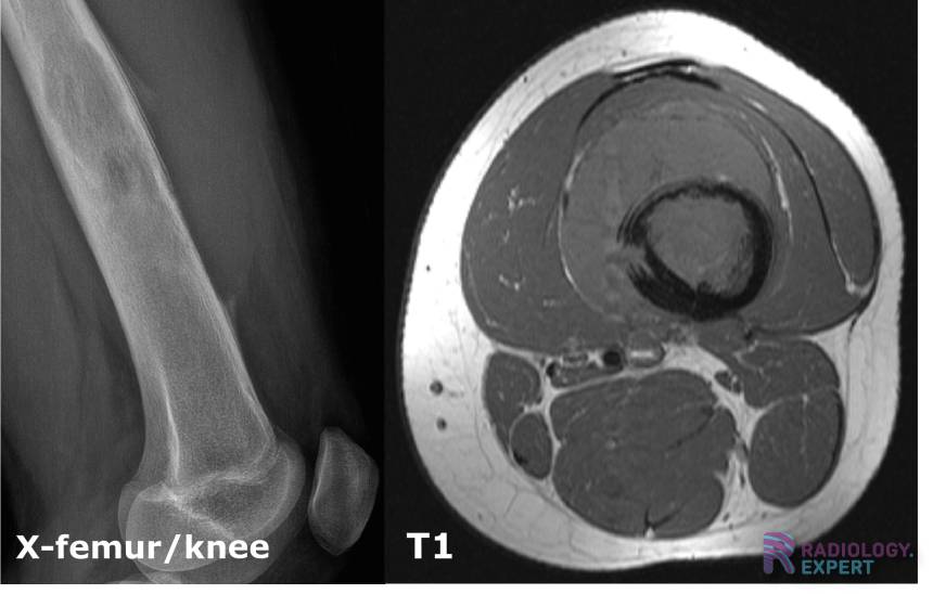 MRI Technique