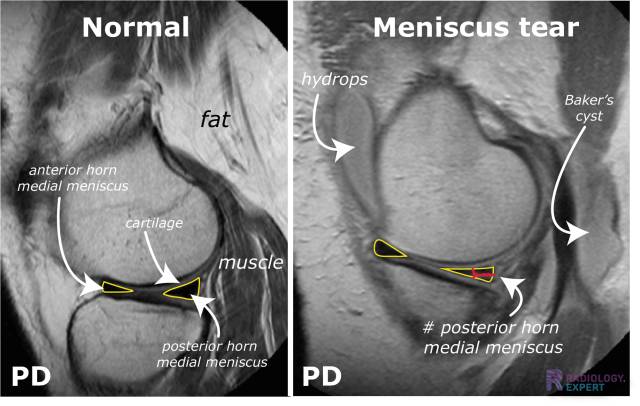 MRI Technique MRI Technique