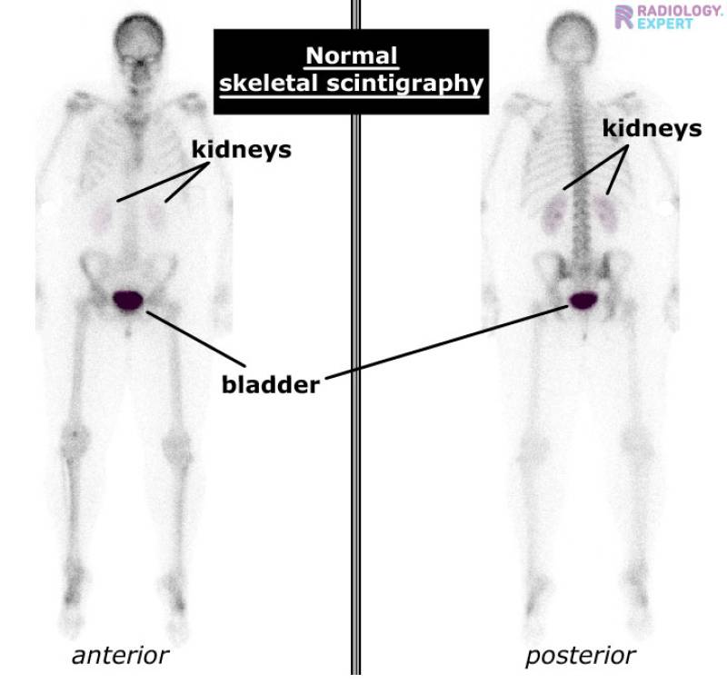Nuclear Medicine