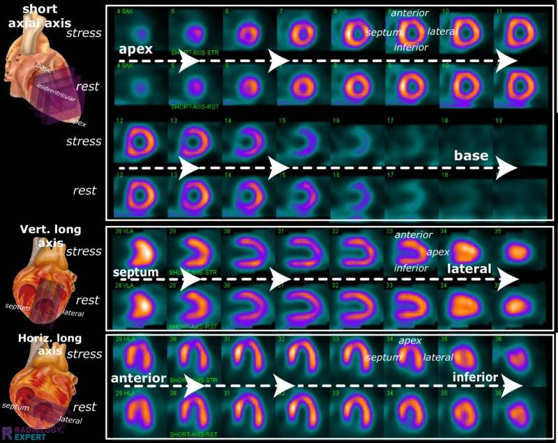 Nuclear Medicine