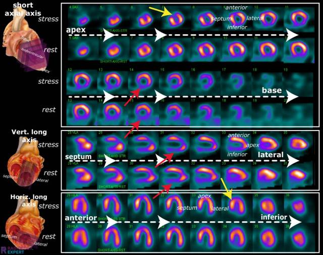 Nuclear Medicine