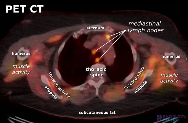 Nuclear Medicine