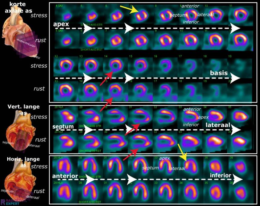 Nucleaire Geneeskunde