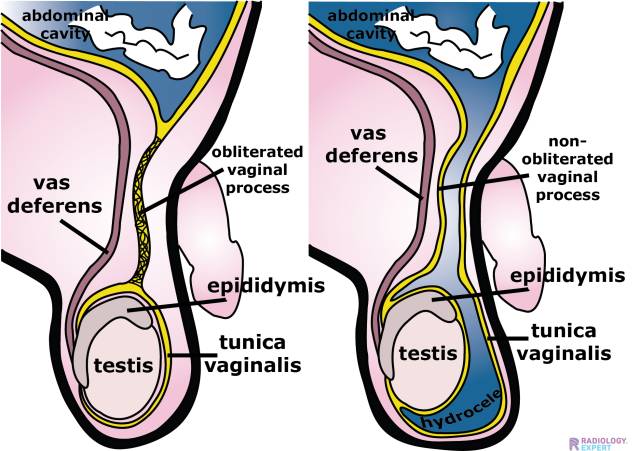 Scrotal Ultrasound