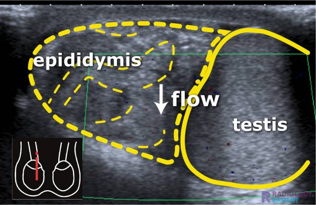 Scrotal ultrasound