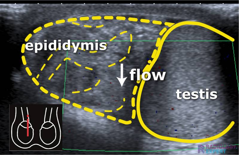 Scrotal ultrasound