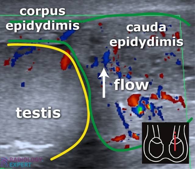 Scrotal ultrasound