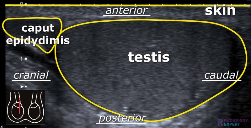 Scrotal ultrasound