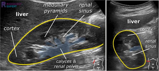 Abdominal ultrasound