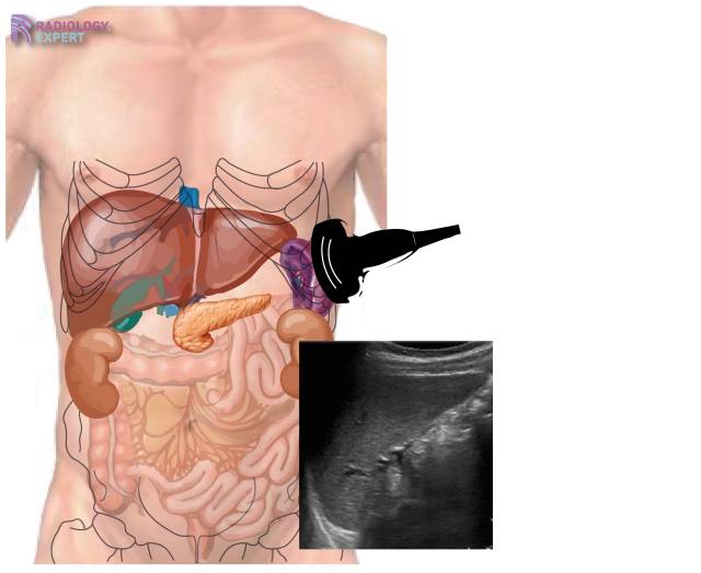pancreas anatomy ultrasound radiology