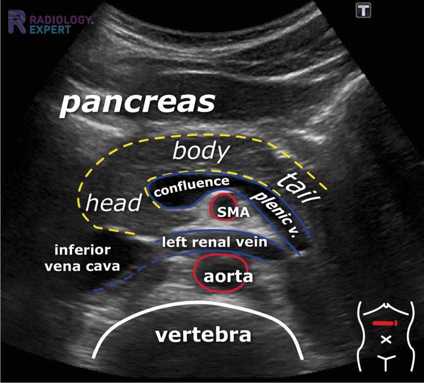 Abdominal ultrasound