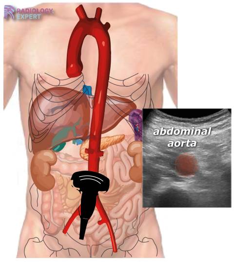 Abdominal ultrasound