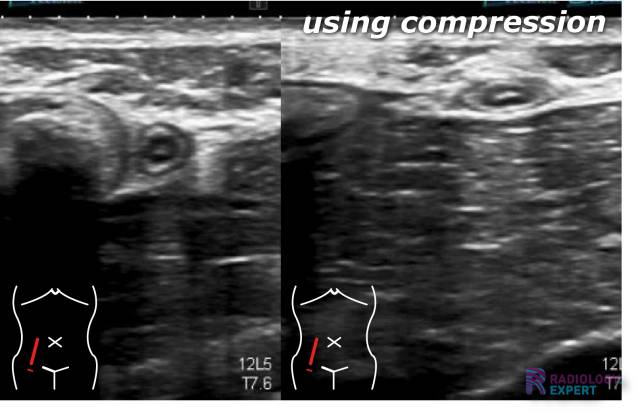 Abdominal ultrasound