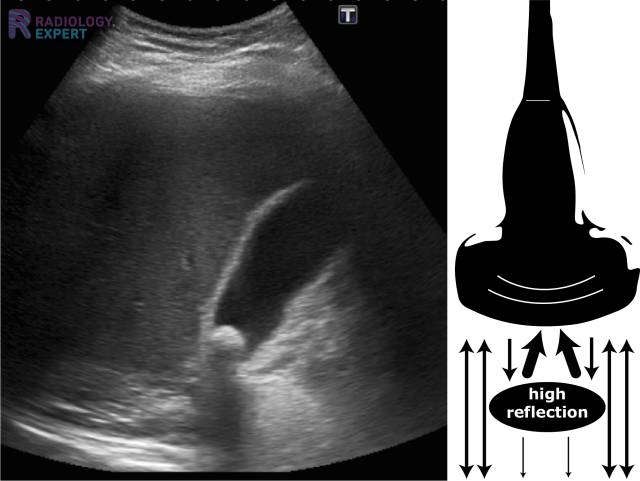 Abdominal ultrasound
