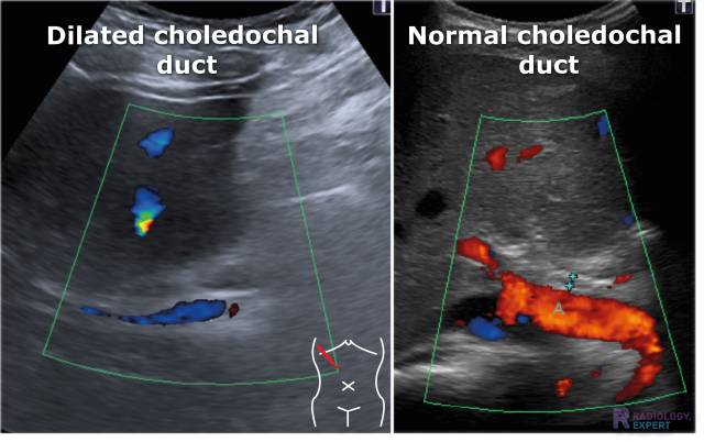 Abdominal ultrasound