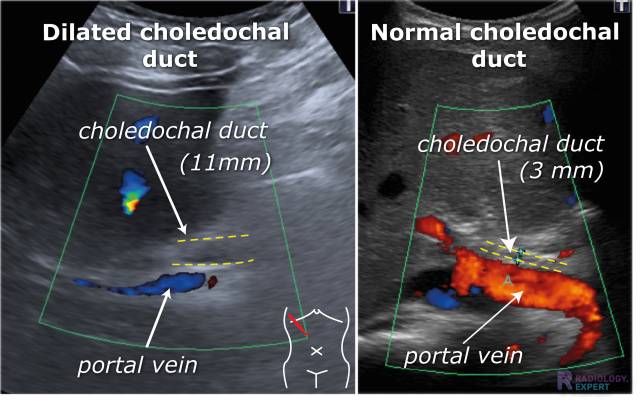 Abdominal ultrasound