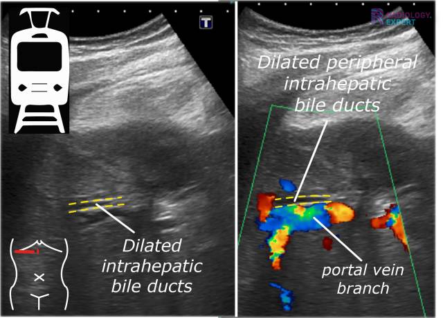 Abdominal ultrasound