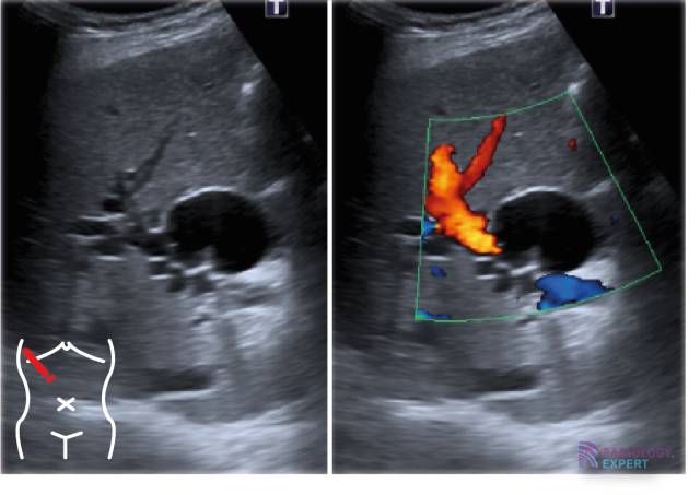 Abdominal ultrasound