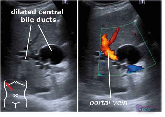 Abdominal ultrasound