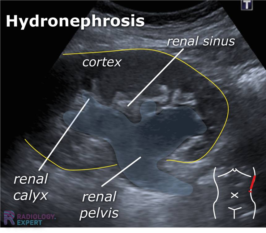 Abdominal ultrasound