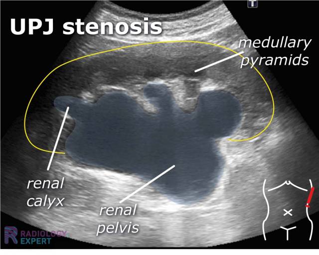Abdominal ultrasound