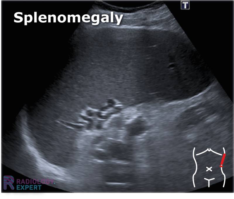 Abdominal ultrasound