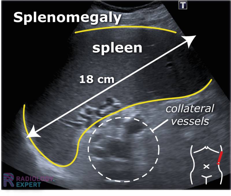 Abdominal ultrasound