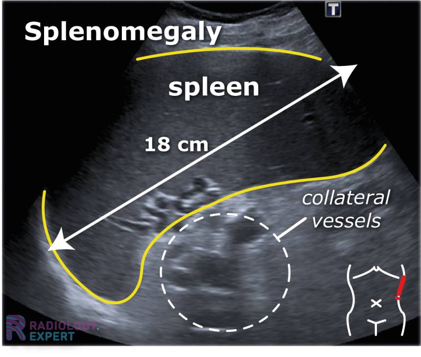 Abdominal ultrasound