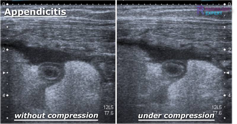 Abdominal ultrasound