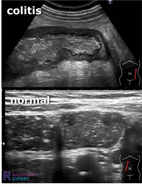 Abdominal ultrasound