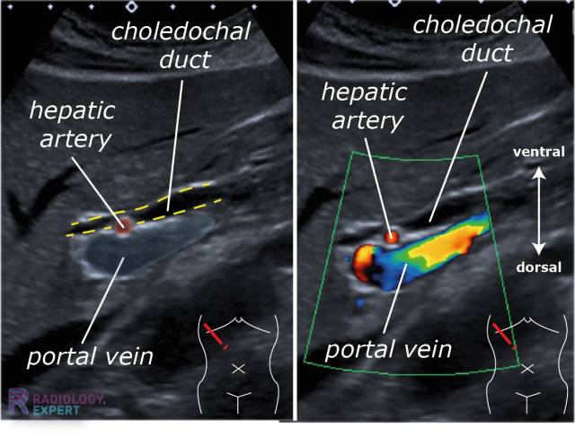 Liver Ultrasound Anatomy