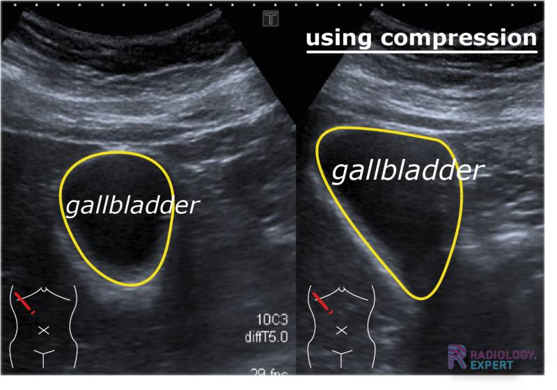 Abdominal ultrasound
