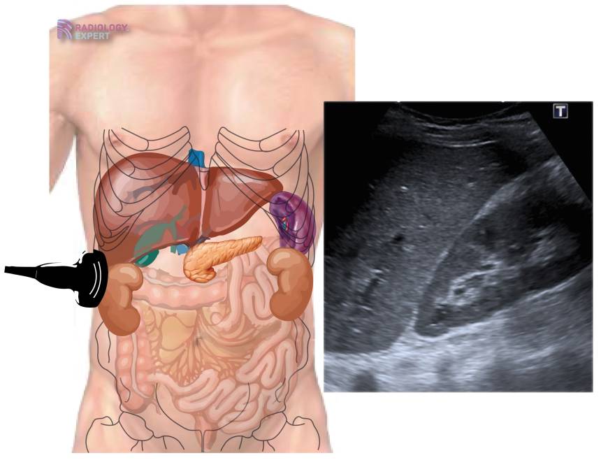 Echo abdomen