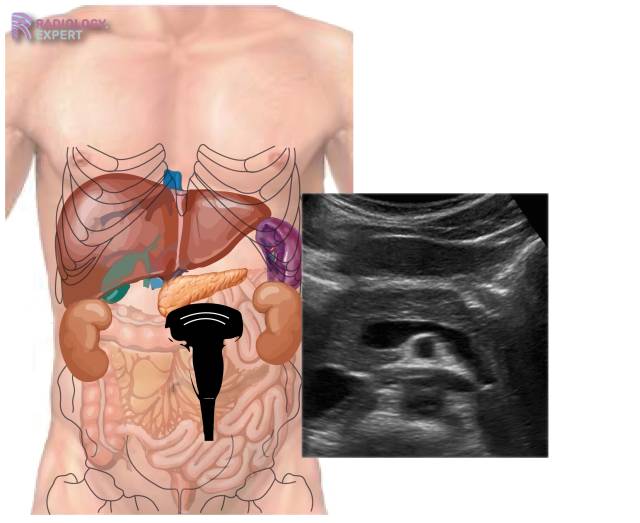 Echo abdomen