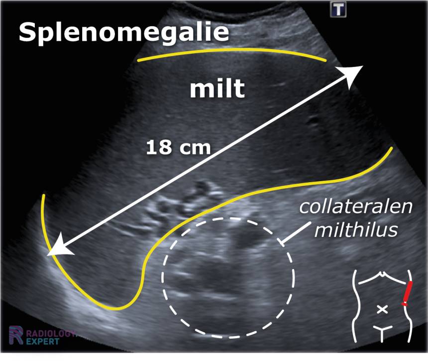 Echo abdomen