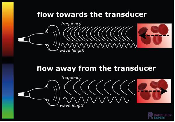 Ultrasound Technique