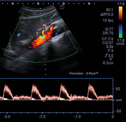 Ultrasound Technique