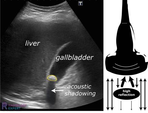 Ultrasound Technique